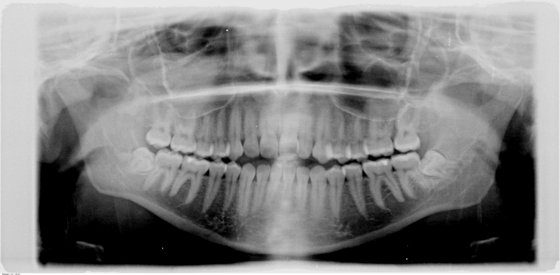Panex Radiographic Film